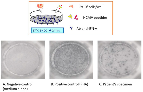 Viruses | Free Full-Text | Herpes Virus Infection in Lung ...
