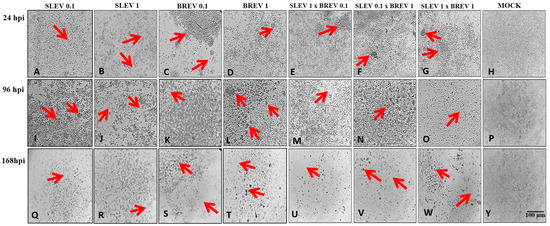 Viral Interference between the Insect-Specific Virus Brejeira and the ...