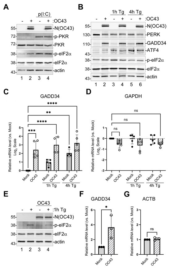 Viruses | Free Full-Text | Human Betacoronavirus OC43 Interferes with ...