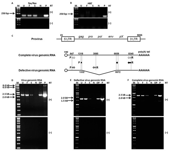 Purification Method of Extracellular Vesicles Derived from Human T-Cell ...