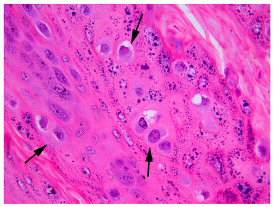 Canis Familiaris Papillomavirus Type 26: A Novel Papillomavirus of Dogs ...