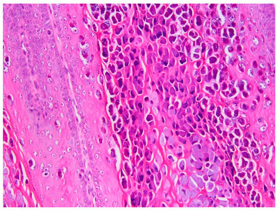 Canis Familiaris Papillomavirus Type 26: A Novel Papillomavirus of Dogs ...