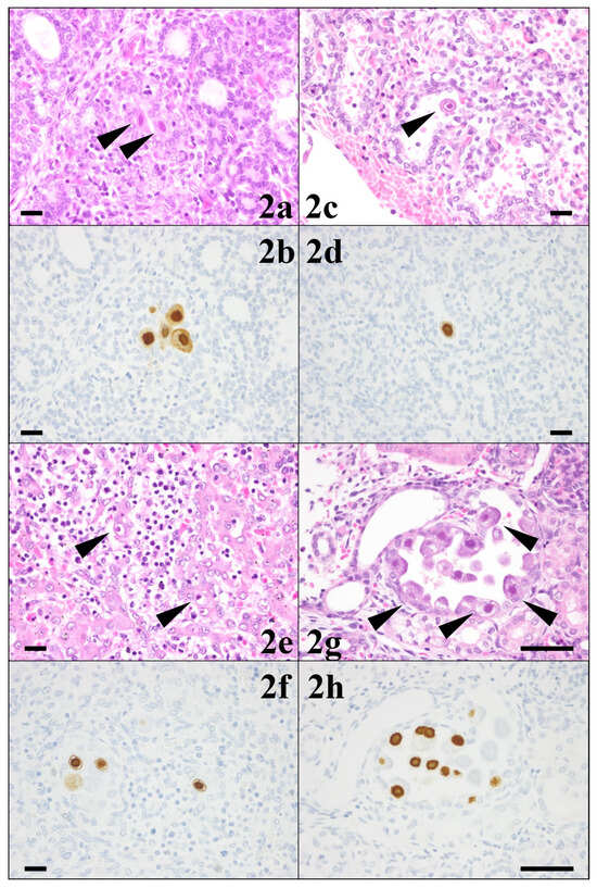 Cytomegalovirus DNA Loads in Organs of Congenitally Infected Fetus