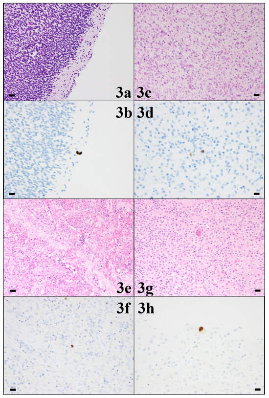 Cytomegalovirus DNA Loads in Organs of Congenitally Infected Fetus