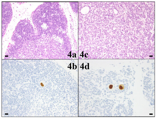 Cytomegalovirus DNA Loads in Organs of Congenitally Infected Fetus
