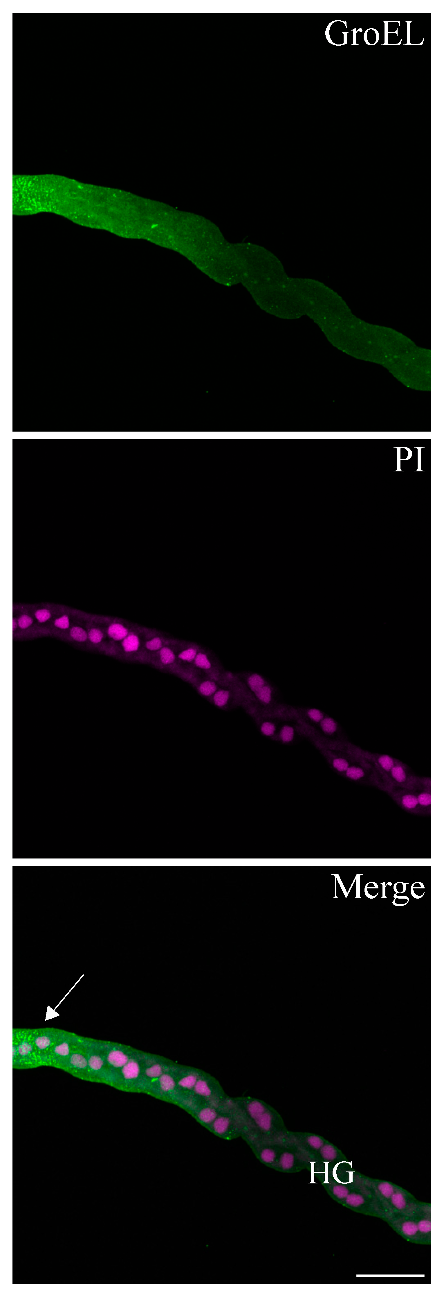 Immunolocalization of Beet Curly Top Virus (BCTV) and GroEL Chaperon ...