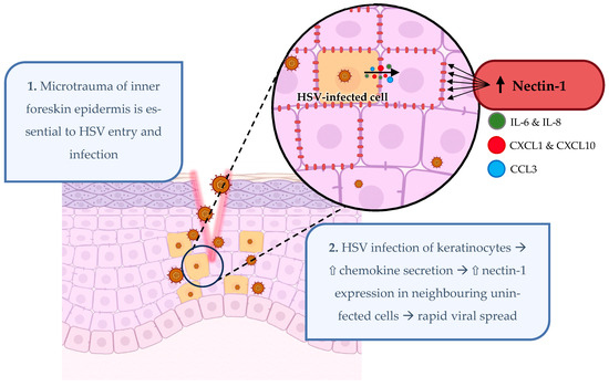 Breaching the Barrier: Investigating Initial Herpes Simplex Viral ...