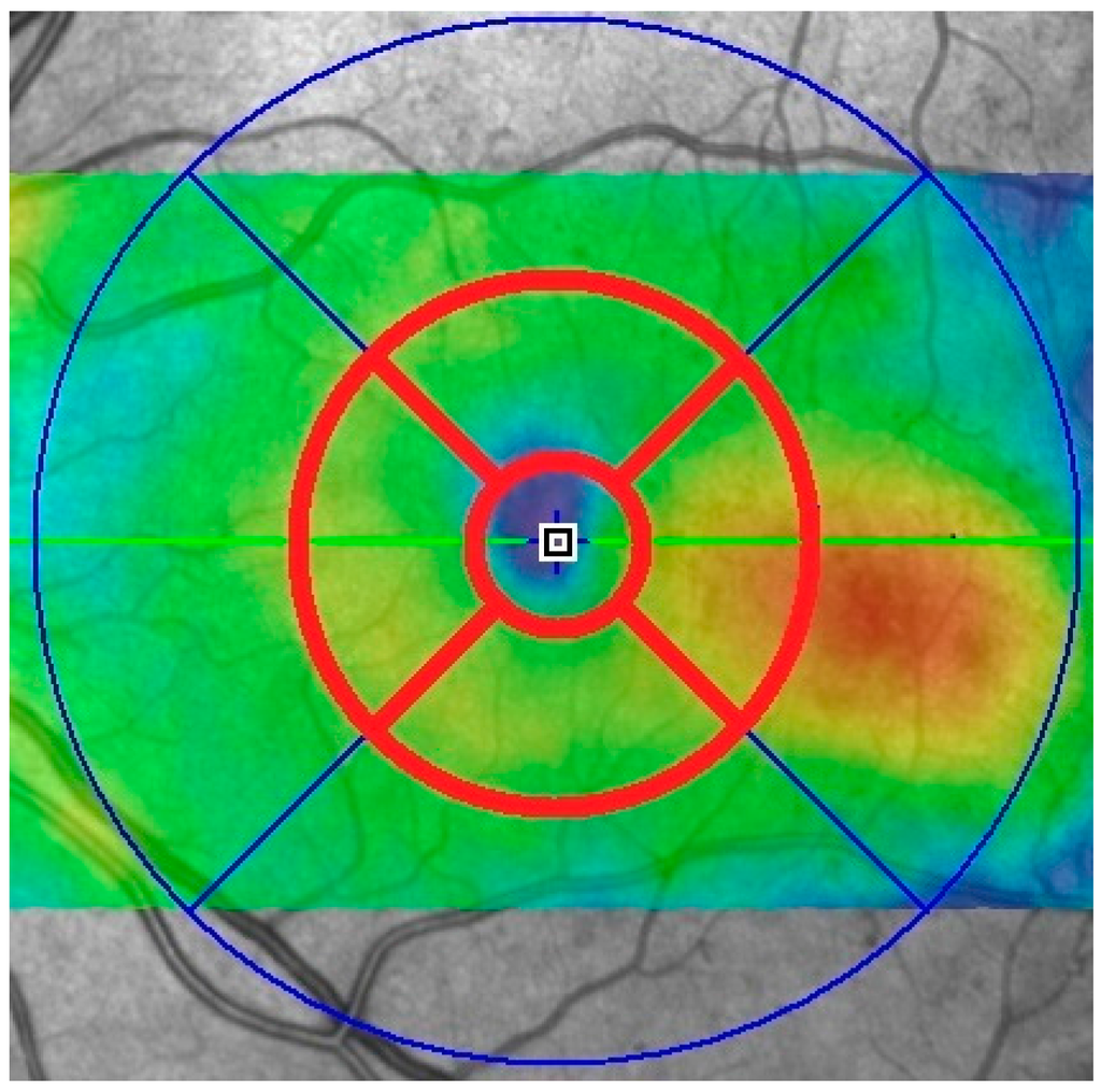 Comparing Macular Thickness Measurements in Patients with Diabetic ...