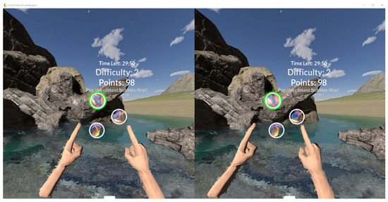 Virtual Reality Visual Training in an Adult Patient with Anisometropic ...