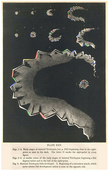 From “Transient Hemiopsia” to Migraine Aura