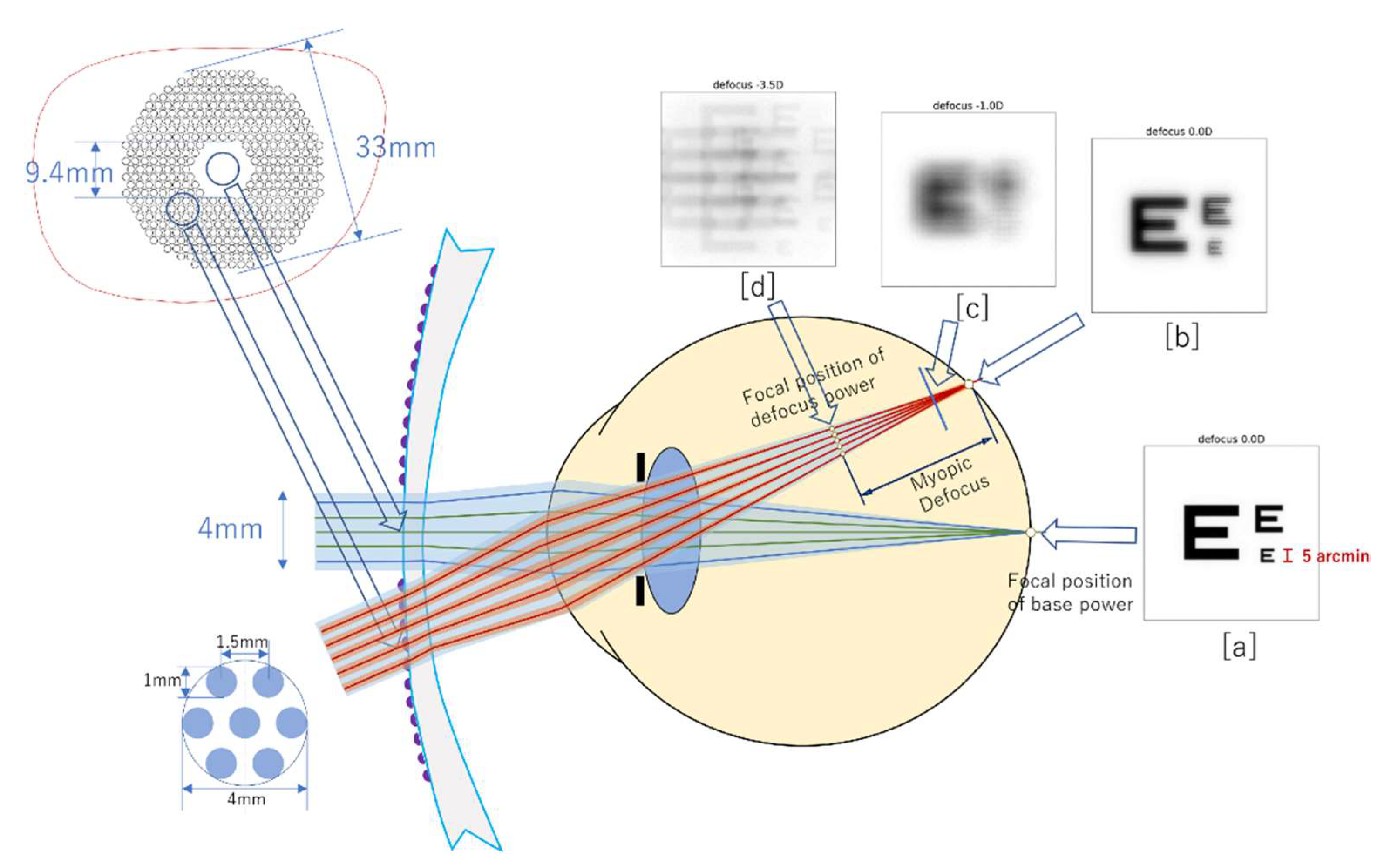 Vision Free Full Text Overview On Defocus Incorporated Multiple