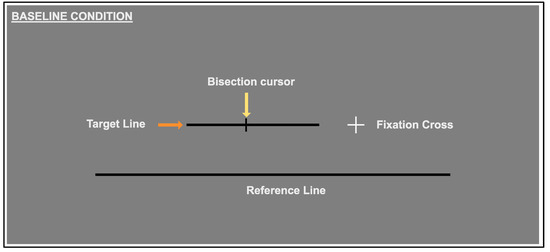 Vision | Free Full-Text | Visual Field Loss: Integrating Overlayed ...