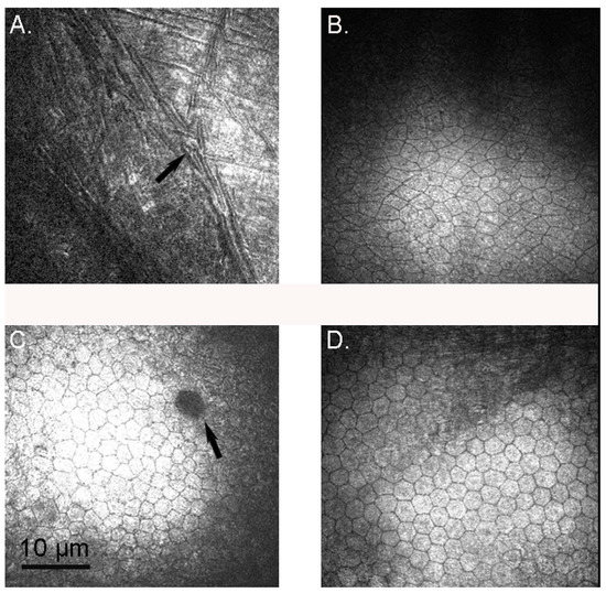 Confocal and Electron Microscopic Structure of the Cornea from Three ...