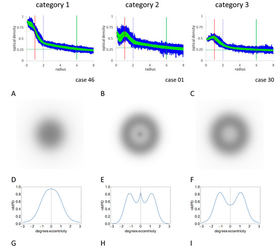The Differential Contribution of Macular Pigments and Foveal Anatomy to the Perception of ...
