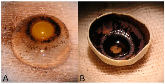Vision | Free Full-Text | A Morphometric Study of the Pars Plana of the ...
