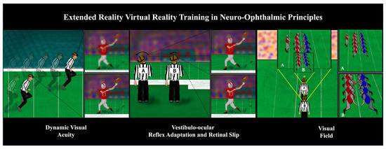Dynamic Visual Acuity, Vestibulo-Ocular Reflex, and Visual Field in ...