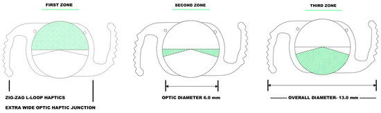 Optical Bench Evaluation of a Novel, Hydrophobic, Acrylic, One-Piece ...