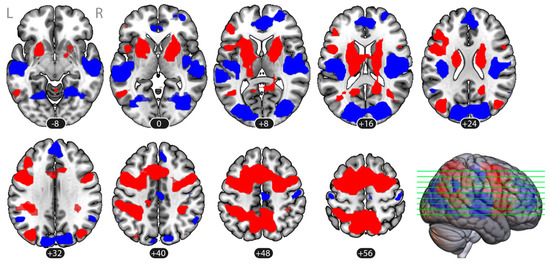 Brain Functional Connectivity During First- and Third-Person Visual Imagery