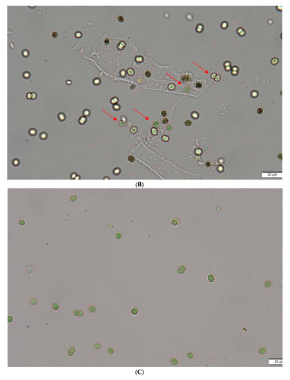 Removal of Microcystis aeruginosa through the Combined Effect of Plasma ...