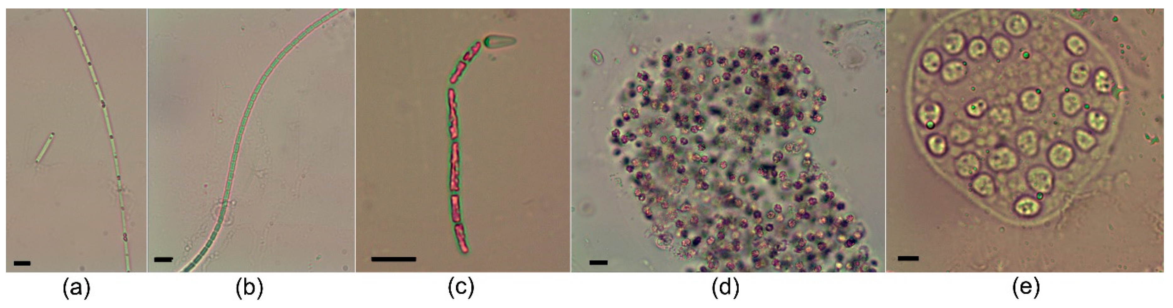 Protected Freshwater Ecosystem with Incessant Cyanobacterial Blooming ...