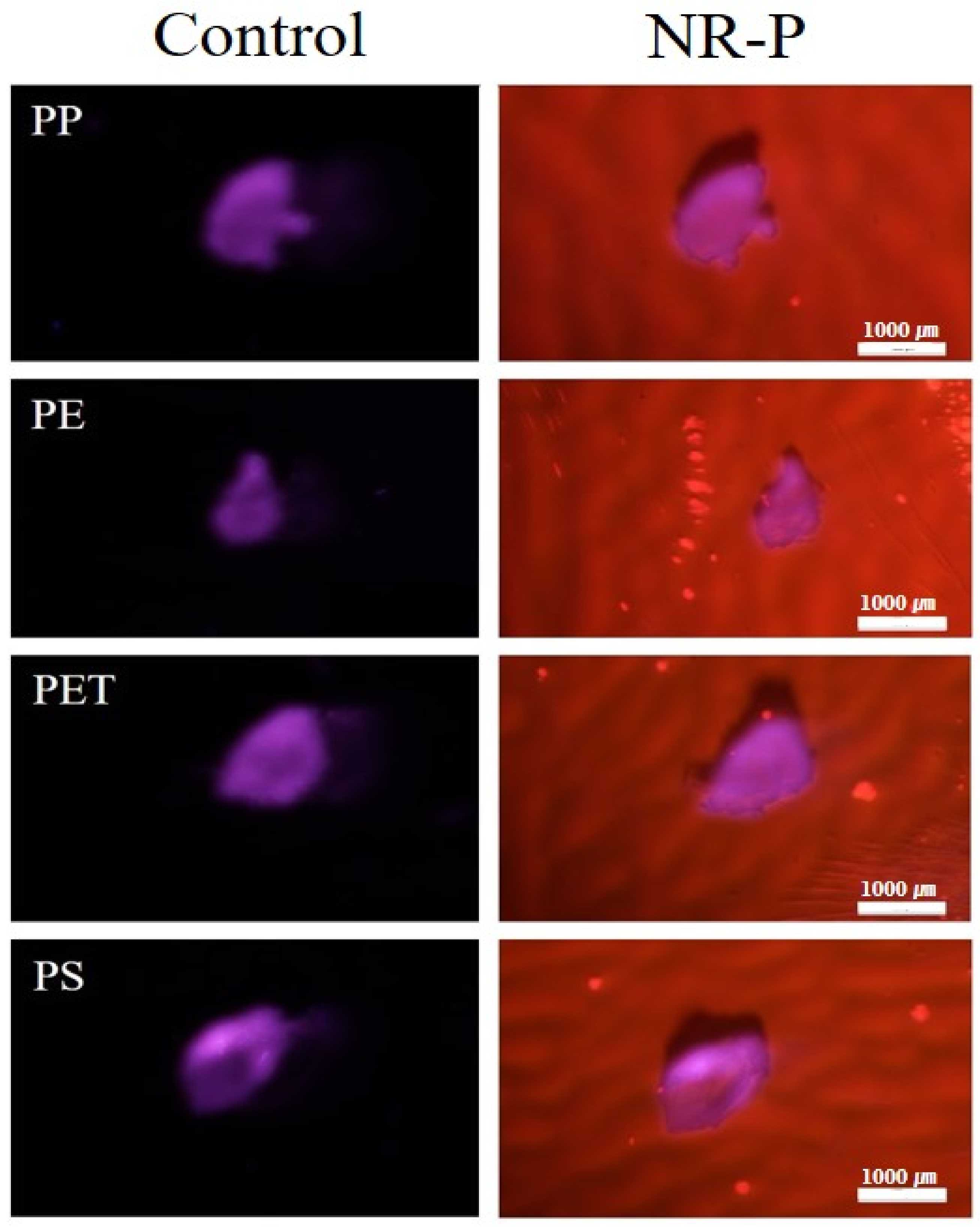 Water | Free Full-Text | Modification of a Nile Red Staining Method for Microplastics Analysis ...