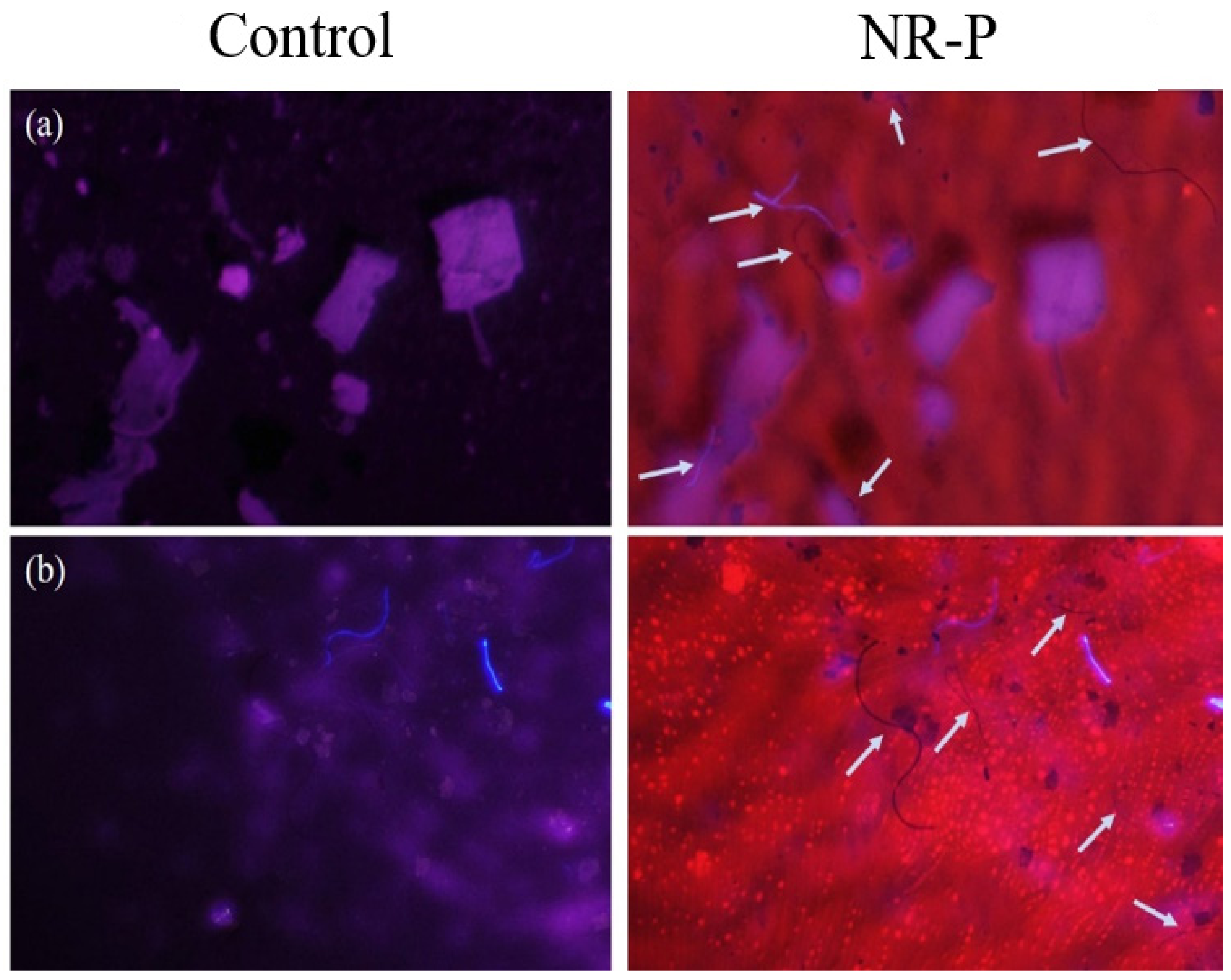 Water | Free Full-Text | Modification of a Nile Red Staining Method for Microplastics Analysis ...