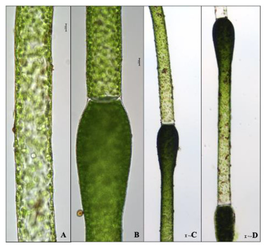 A Morphological and Molecular Analysis of a Bloom of the Filamentous Green Alga Pithophora
