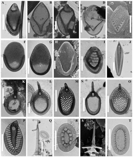 Diversity of Silica-Scaled Chrysophytes in Central Vietnam