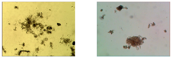 Combination of Microscopic Tests of the Activated Sludge and Effluent ...