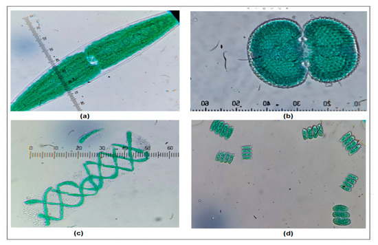 Computer Vision Based Deep Learning Approach for the Detection and Classification of Algae ...