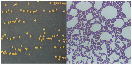 Water | Free Full-Text | Kinetic Models of Disinfection with Sodium ...