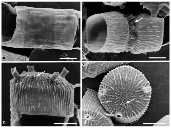 Possible Origin and Distribution of an Invasive Diatom Species ...