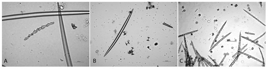 Anomalies of Sponge Spicules: Exploring Links to Environmental Pollution