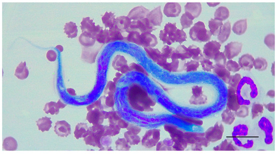 Incidental Finding of Dirofilaria immitis (Spirurida: Onchocercidae ...