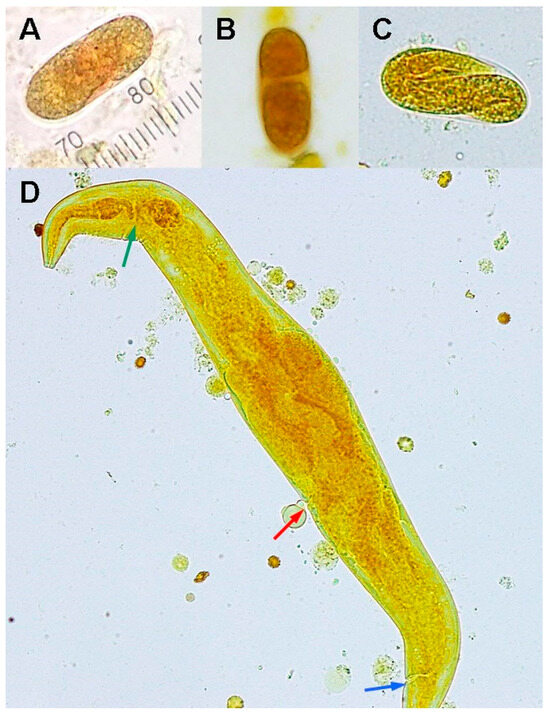 Human Exposure to Equine Halicephalobus gingivalis in an Occupational ...
